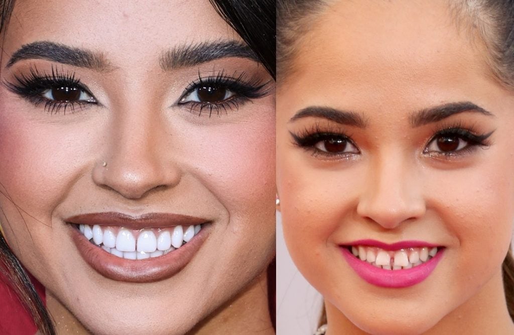 Becky G’s Red Carpet Evolution: Iconic Looks and Smile Makeover