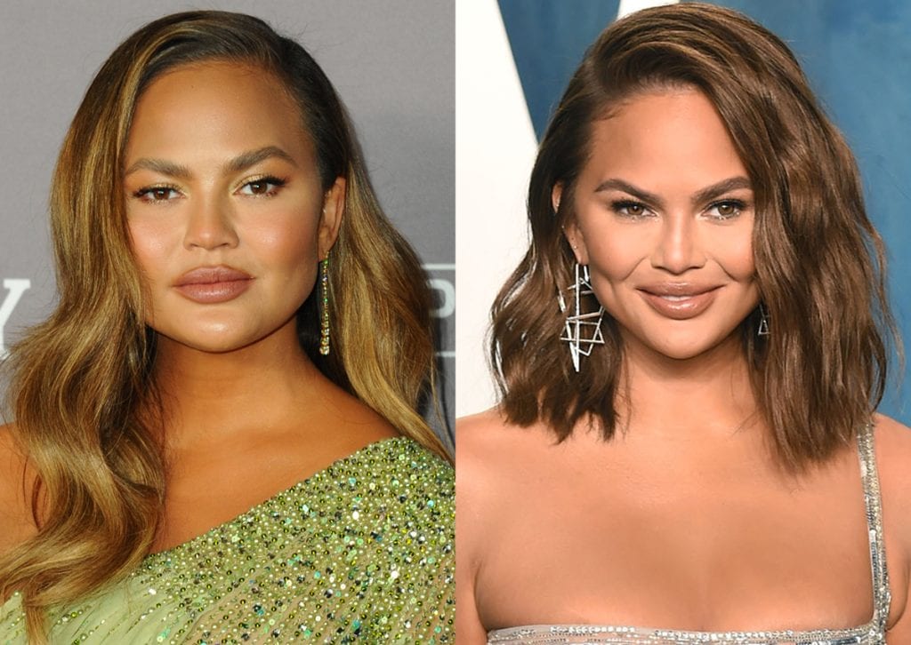 Did Liam Payne Undergo Buccal Fat Removal? Singer Shocks Fans With New ...