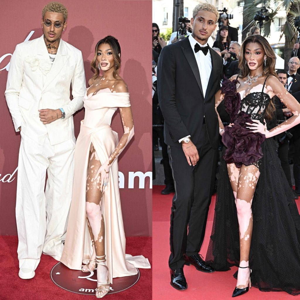 Winnie Harlow and Kyle Kuzma Turn Heads at Cannes Film Festival in ...